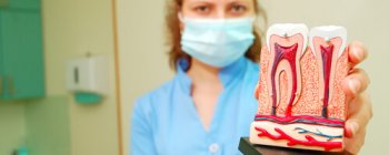 Candida (Mundsoor): Wie der Pilz im Mund behandelt wird