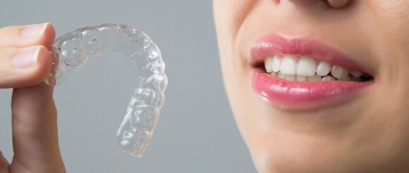 PlusDental: Kosten der Aligner, Erfahrungen und mögliche Alternativen.