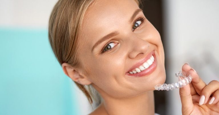 Invisalign Gummis: Wie werden die Gummizüge befestigt?