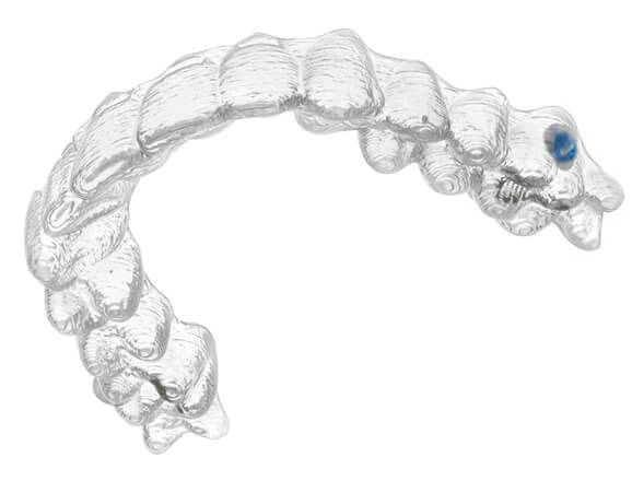 Invisalign for Teens: Invisible Braces for Under-18s in the UK