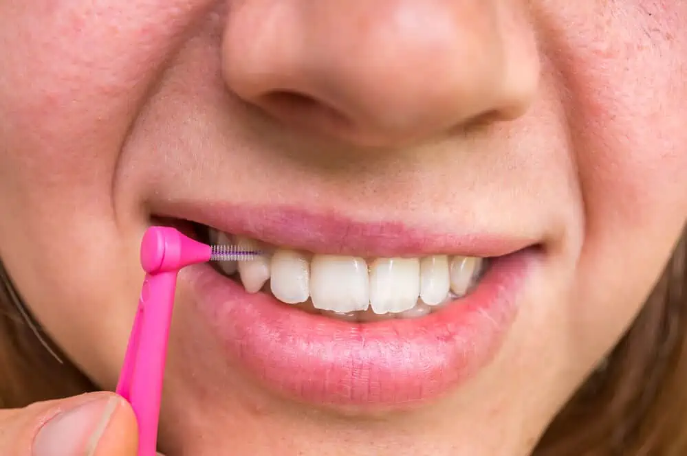 Interdental Brushes: Best Brands, Sizes & How to Use Them