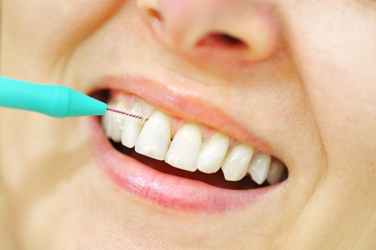Interdental Brushes: Best Brands, Sizes & How to Use Them