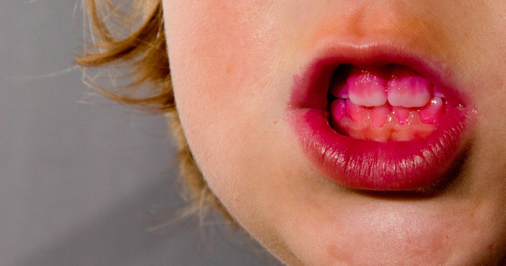 How to Use Plaque Disclosing Tablets to Show Plaque on Teeth