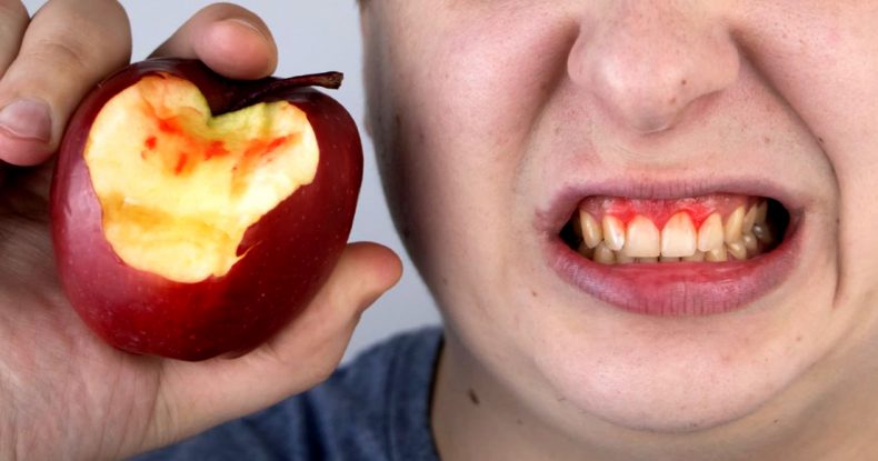 Complete Guide to Oral Health for You and Your Family