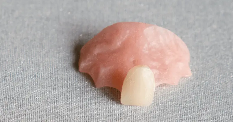 Single Tooth Dentures: What Are They and How Much Do They Cost?