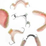 Chrome Dentures: What are they and how much do they cost in the UK?