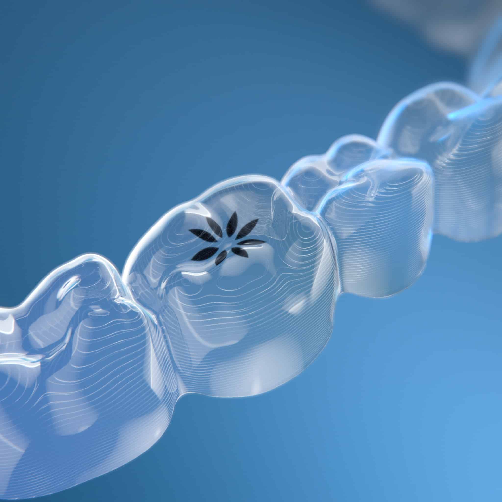 Invisalign Lite Costs, Treatment Experience & Reviews (UK)