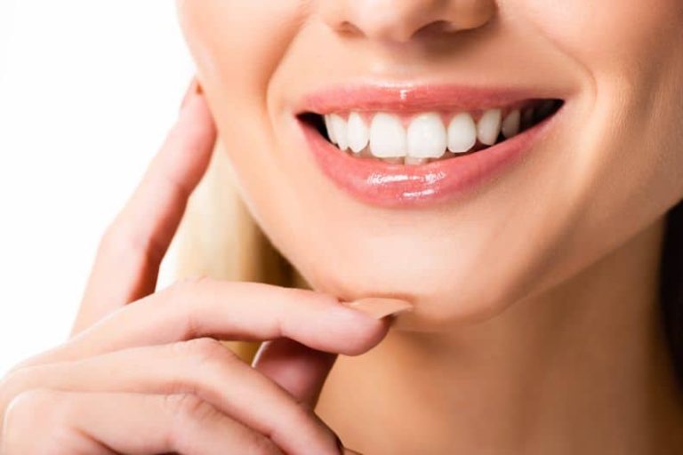 Smile White Aligners Before and After: Compare Real Treatment Results