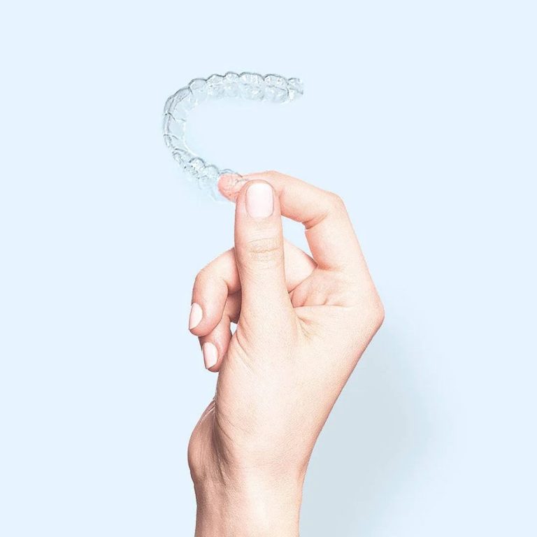 How Much Do Retainers Cost in the UK? Which Type is Best?