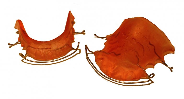 Retenedores dentales: para qué sirven, precios y tipos