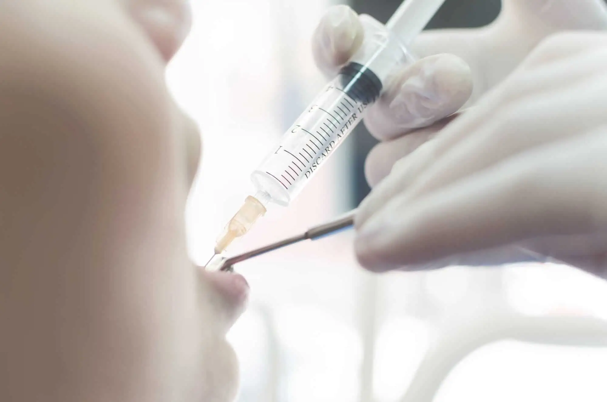 Macroglosia: causas y mejores tratamientos para la lengua grande