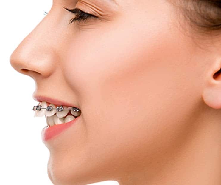 Retrognatia mandibular: ¿Cuáles son sus causas?