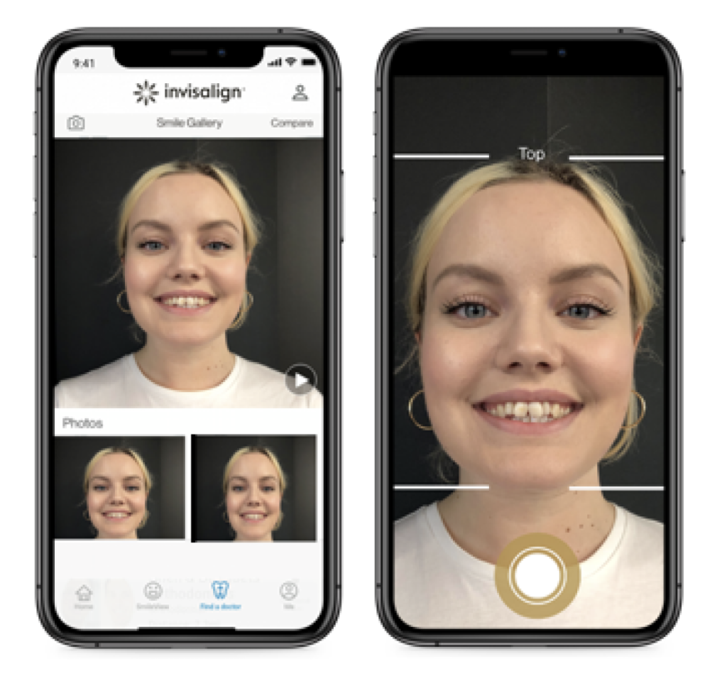 My Invisalign App: qué es y para qué sirve la aplicación móvil