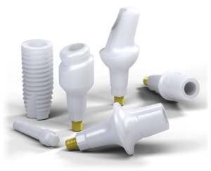 Implantes Straumann Opiniones: Pros y Contras, precios y más