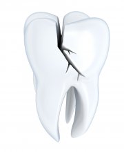 Chipped Tooth Repair: Treatment Costs and Pain Relief - Dentaly.org