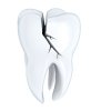 Chipped Tooth Repair: Treatment Costs and Pain Relief - Dentaly.org