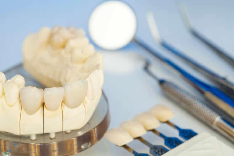 Emax Crowns Guide: What Are They and How Much Do They Cost?