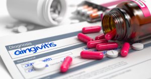 Dental Antibiotics for Tooth Infection, Surgery, and More - Dentaly.org