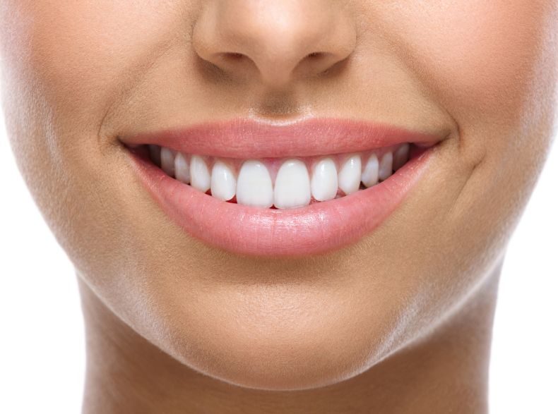 TruSmile Veneers Review: Are They Worth the Price? - Dentaly.org