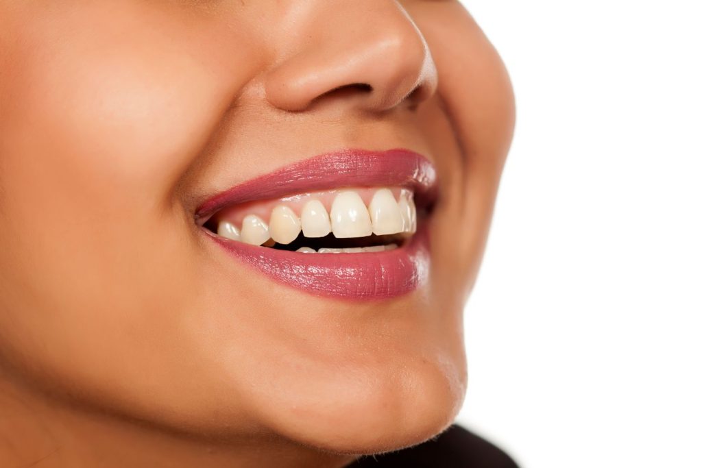 Brown Stains on Teeth? How to Remove Them Quickly - Dentaly.org