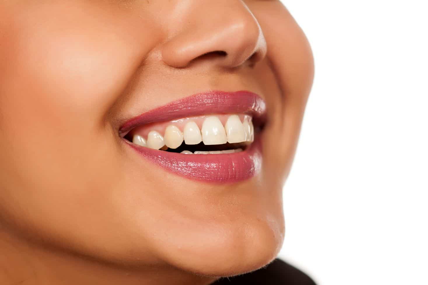 Brown Stains on Teeth? How to Remove Them Quickly - Dentaly.org