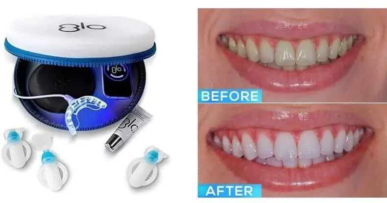 GLO Science Teeth Whitening Review: Does it Really Whiten? - Dentaly.org