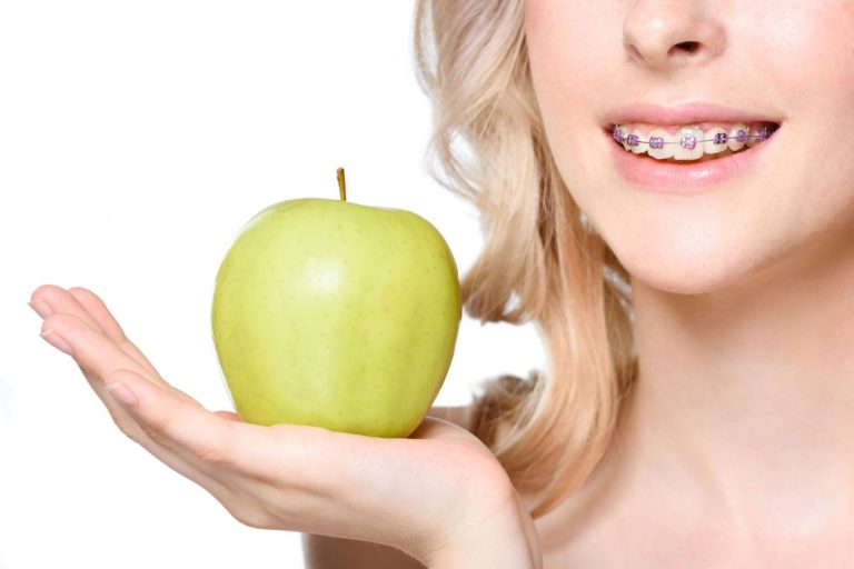 What Can You Eat with Braces the First Day? List of Top Meals & Snacks ... What Can You Eat with Braces the First Day? List of Top Meals & Snacks ...