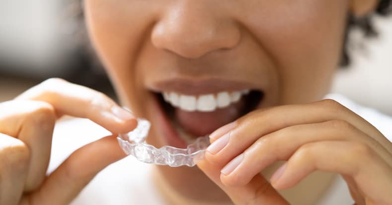 Byte Nighttime Aligners: Reviews of Cost and Treatment - Dentaly.org