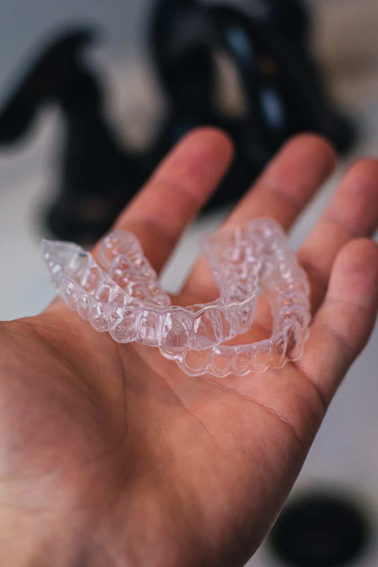 Retainer Replacement: Do You Need It and What's the Cost?