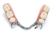 Stellite dentaire : la prothèse dentaie amovible et abordable