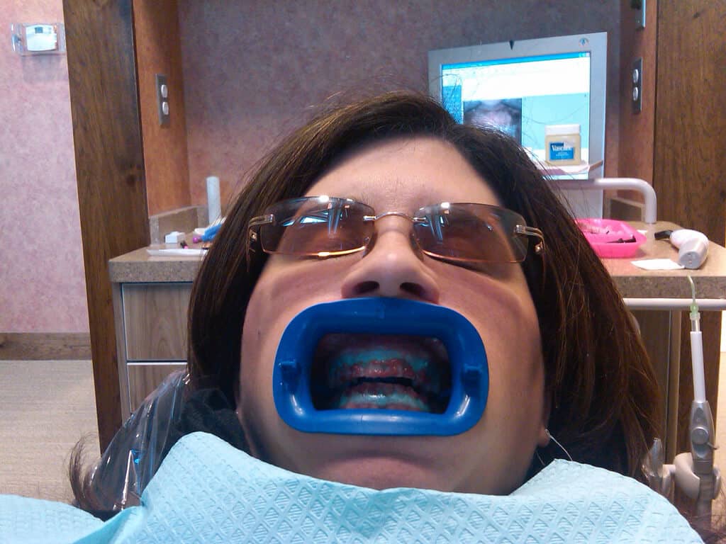 Dents jaunes : notre dossier complet - Solutions et causes