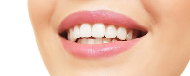 Facettes dentaires : tout ce qu'il faut savoir avant d'en poser