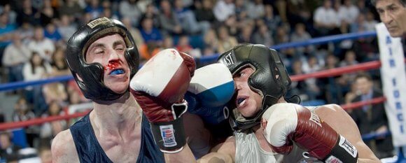 Prognathe : definition, causes et solutions - Dentaly