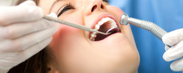 Détartrage des dents : technique et fréquence à adopter