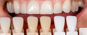 Prognathe : definition, causes et solutions - Dentaly