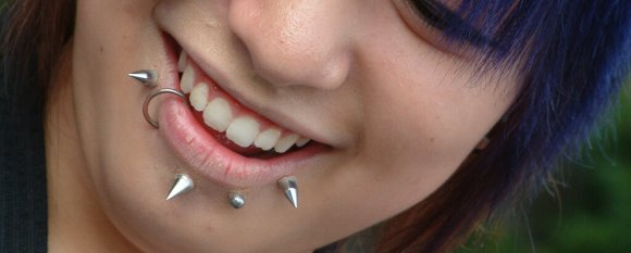 Grillz et strass dentaire : notre avis sur les bijoux des dents