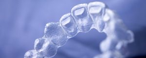 Élastiques Invisalign : guide complet et recommandations